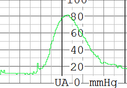 9_UA Tool_Charting_V2 | OBIX P.O.E.T.